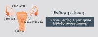 Ενδομητρίωση: Αιτίες, Συμπτώματα και Τρόποι Αντιμετώπισης